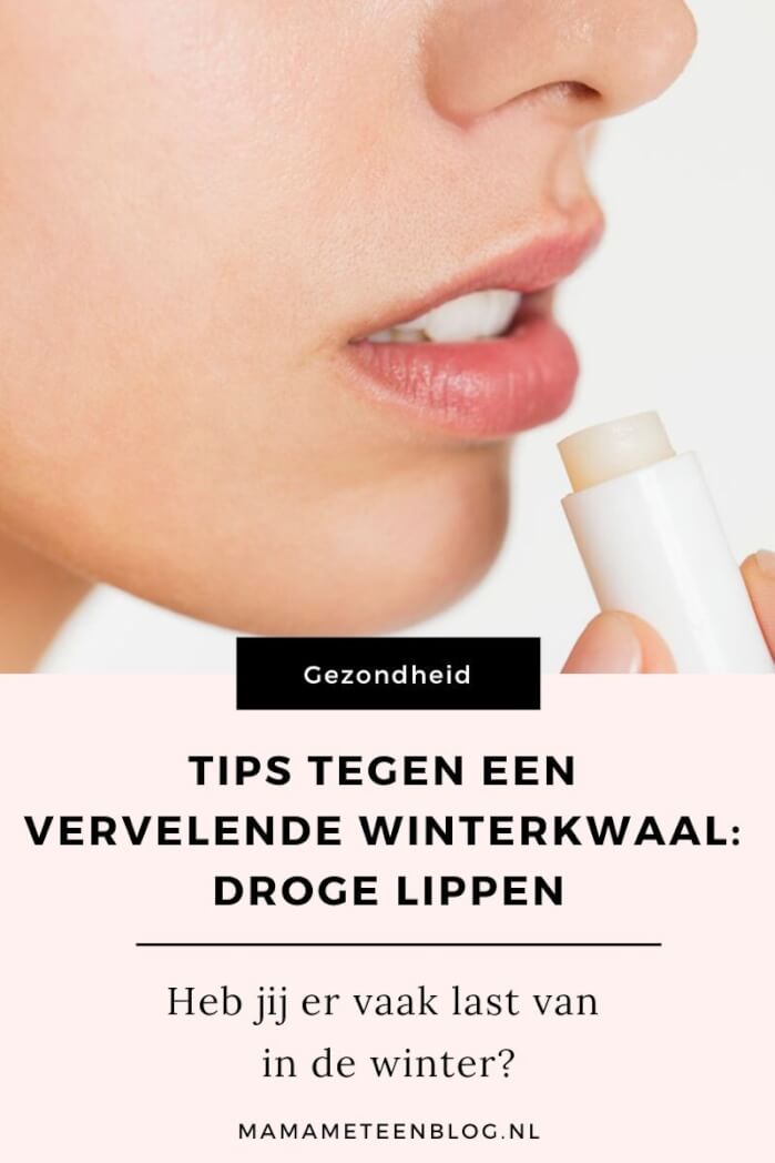 Tips tegen een vervelende winterkwaal: droge lippen
